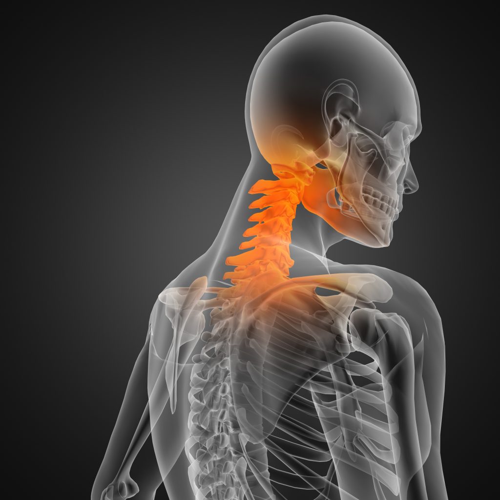 A Guide To Neck Injury Claims - Find Out How Much Compensation